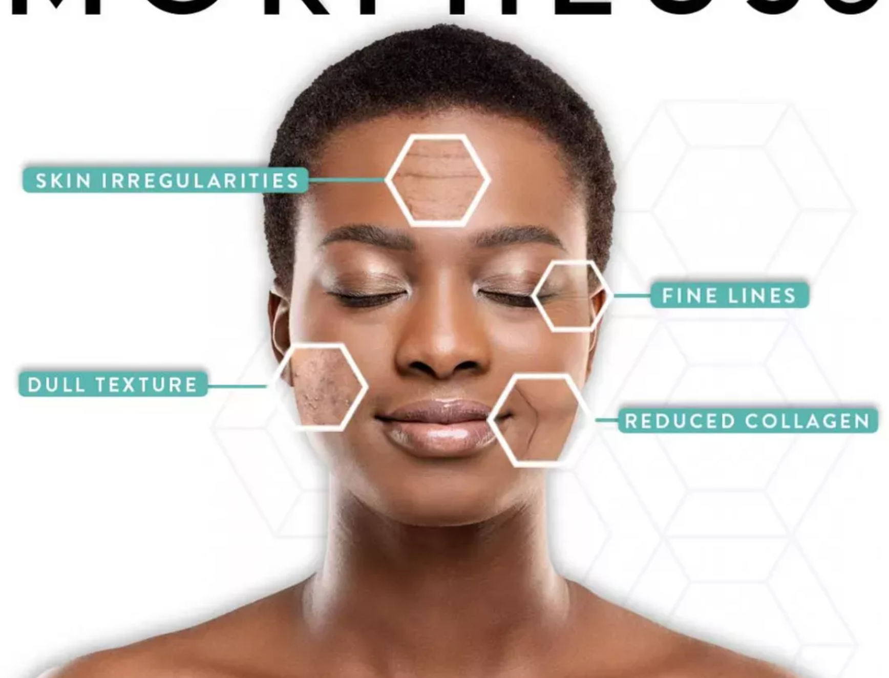 Morpheus8 Treatment Guide: Benefits, Safety, Results